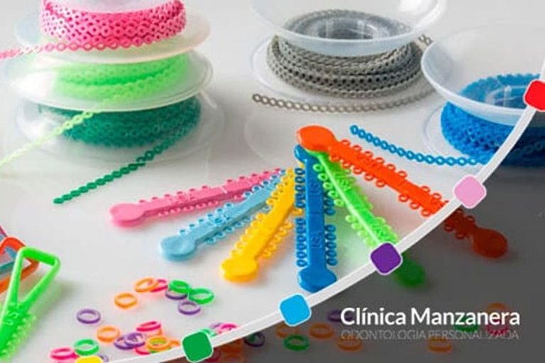 Levantes de mordida o Topes Ortodoncia: Dr. David Manzanera