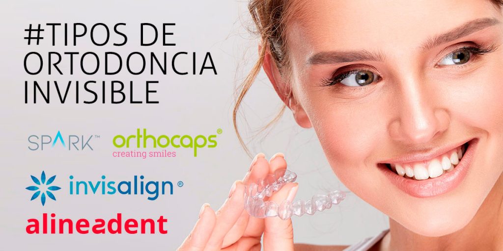 El uso de elásticos con ortodoncia Invisalign - Clínica Manzanera